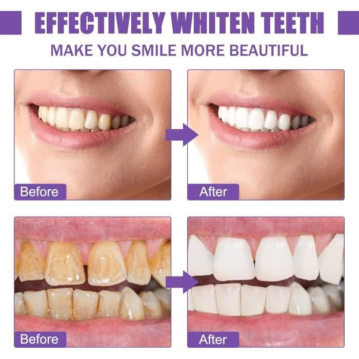 Dentifrice Blanchissant Violet 3Pcs V34 Colour Corrector Dentifrice ...