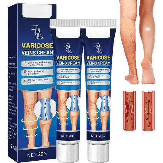 CC Crème Pour Varices,Réduit Les Varicosités Et La Lourdeur,Soulagement ...