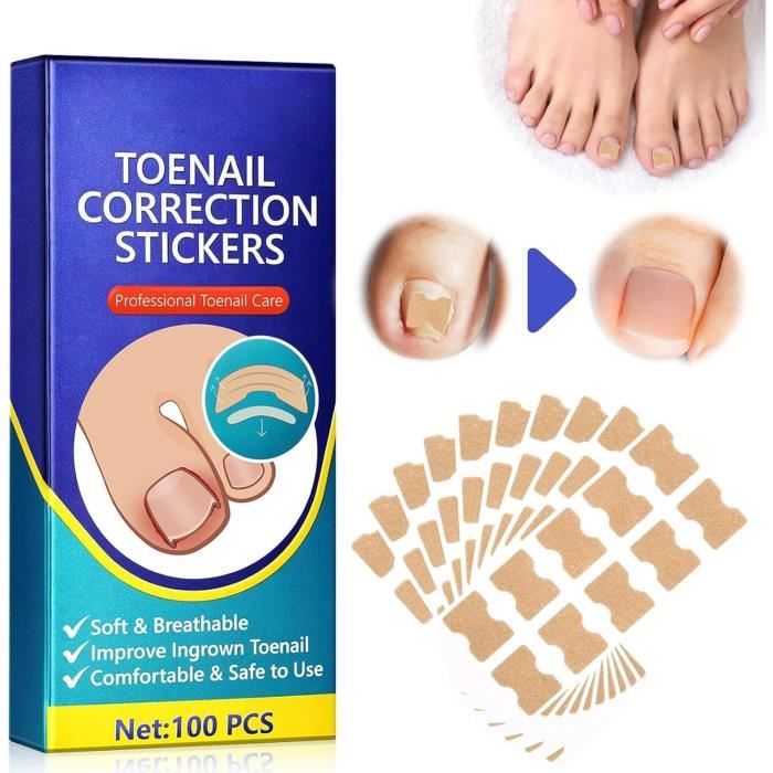 Patch Correcteur Toenail, Ongle Incarné Orteil, Avec Patch Élastique ...