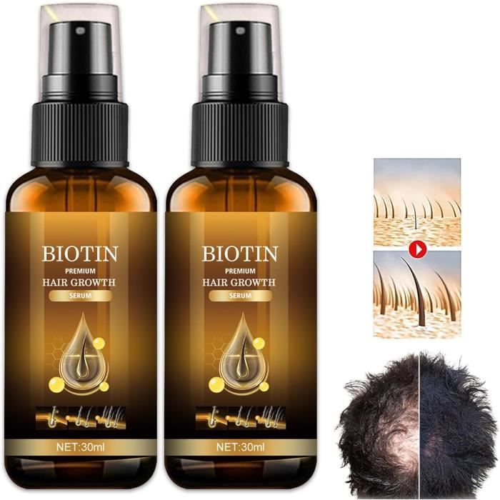 Biotin Hair Growth Spray, Hair Growth Oil, Hair Growth Serum, Hair ...