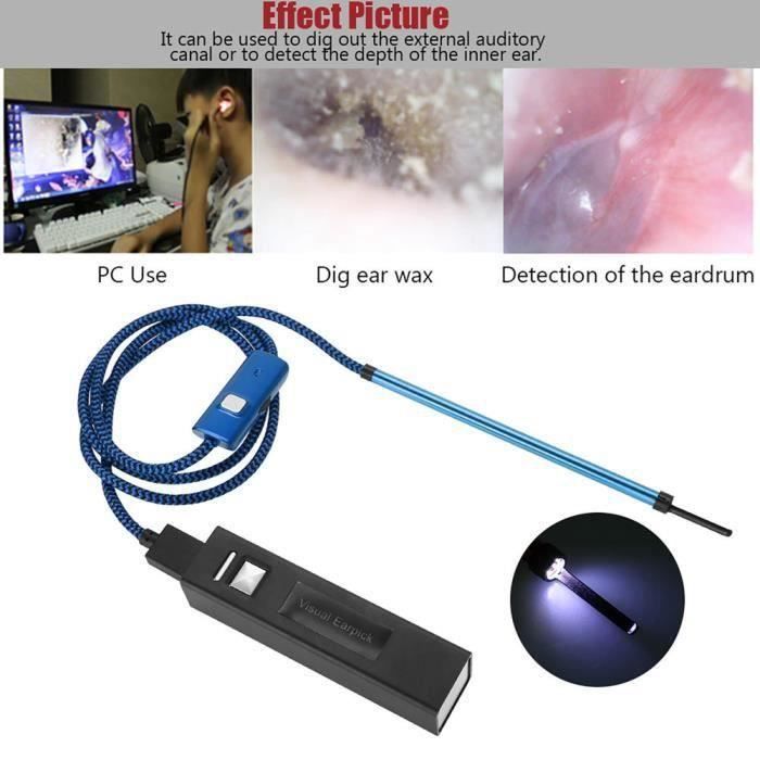 Serious-endoscope auriculaire HD 4 couleurs numérique WIFI LED Otoscope ...