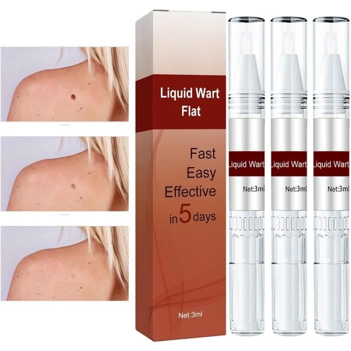 Verrue Plate - Traitement Verrues Plantaires, Élimination Des Verrues ...