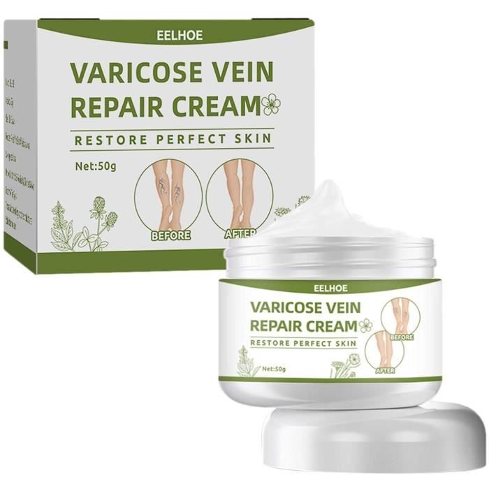 Varices Crème Spider Leg Repair Cream Spider Vein Cream for Legs ...