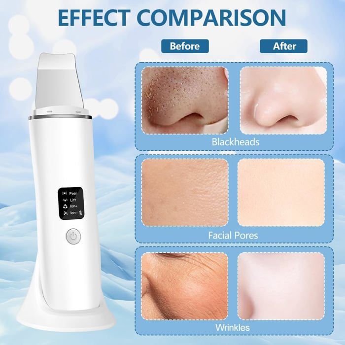 Épurateur de Peau Ultrasonique, Nettoyeur Visage avec 4 Modes, Skin ...