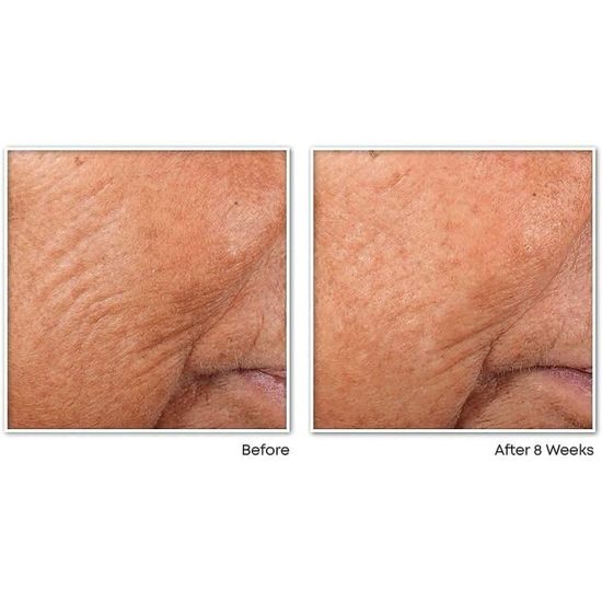 Soin Pour Le Visage - Retinol Correxion Lissant Sérum Nuit Anti-Rides Vieillissement Hydratant ...