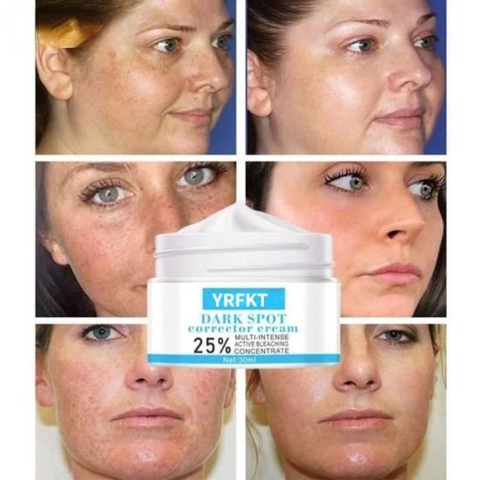 5G - Fade Melanin Natural Extract, Dark Spot Cream - Cdiscount Au quotidien