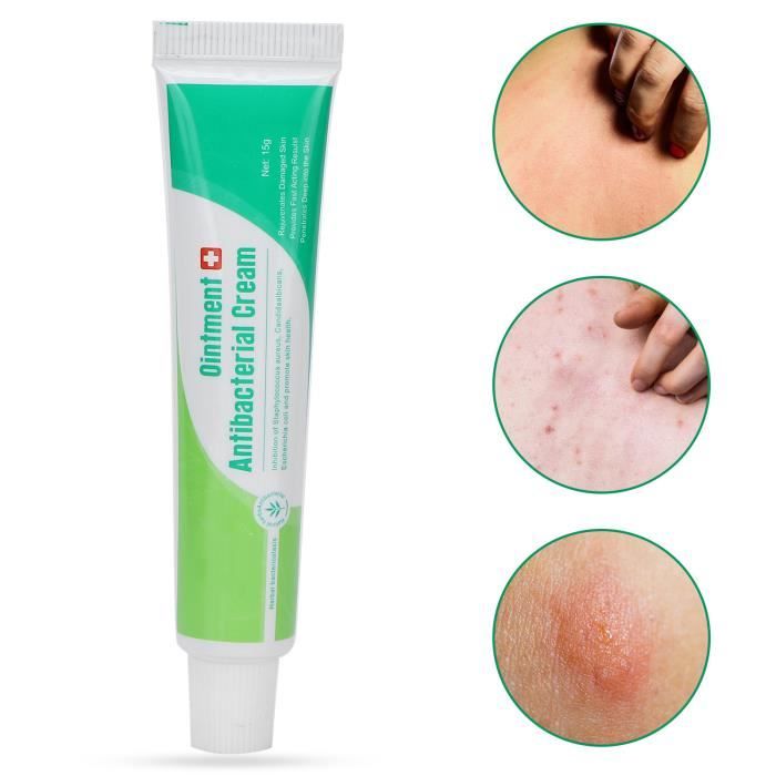 Zerodis Pommade anti-démangeaisons 15 G de Crème Anti-Démangeaisons ...