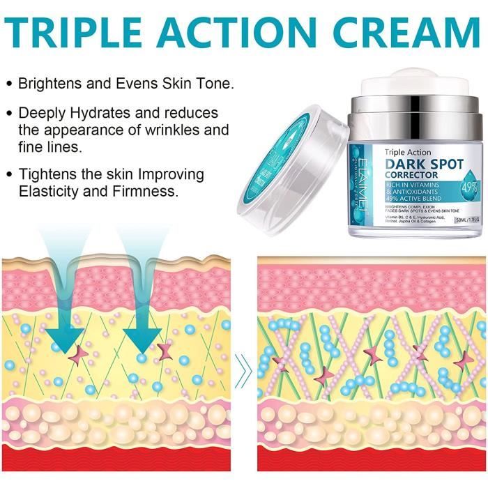 Crème Anti Tache Visage, Taches Brunes Correcteur, Dark Spot Remover ...