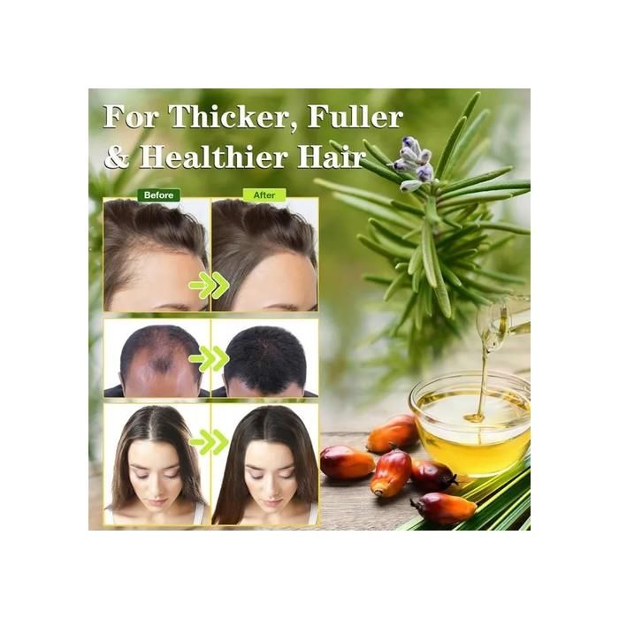 Huile pour la Pousse des Cheveux à Huile de Batana et Huile de Romarin, Serum Pousse Cheveux ...