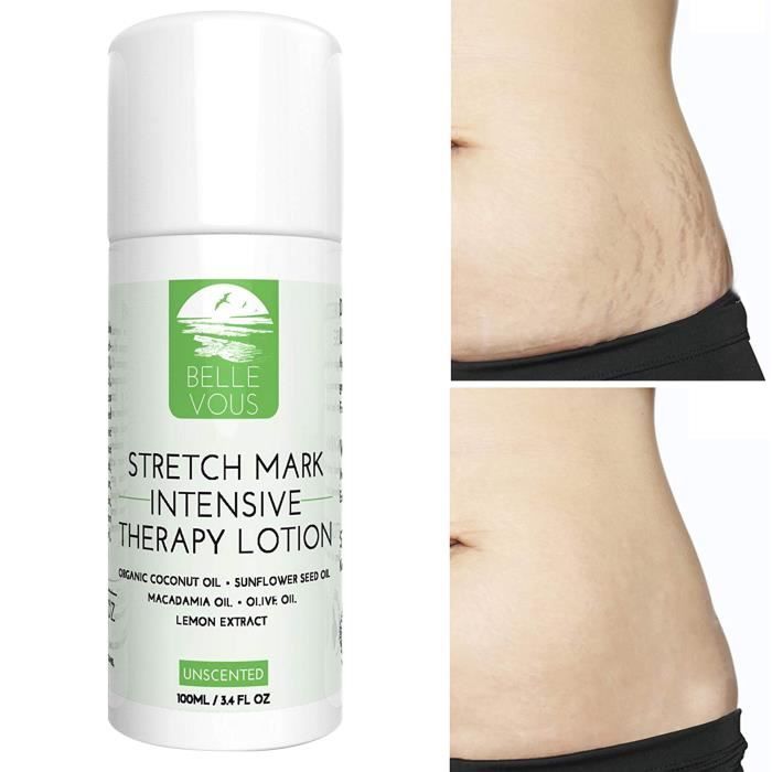 Soin Vergetures & Cicatrices- Huiles & Ingrédients ORGANIQUES NATURELS ...