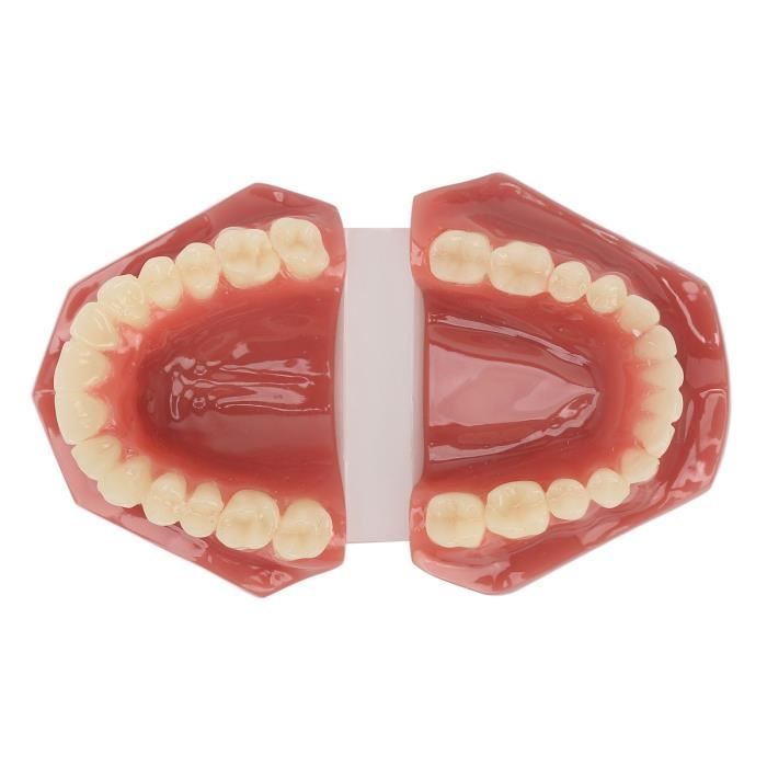 SURENHAP Modèle de prothèse adulte Modèle de dent 28 dents, modèle ...