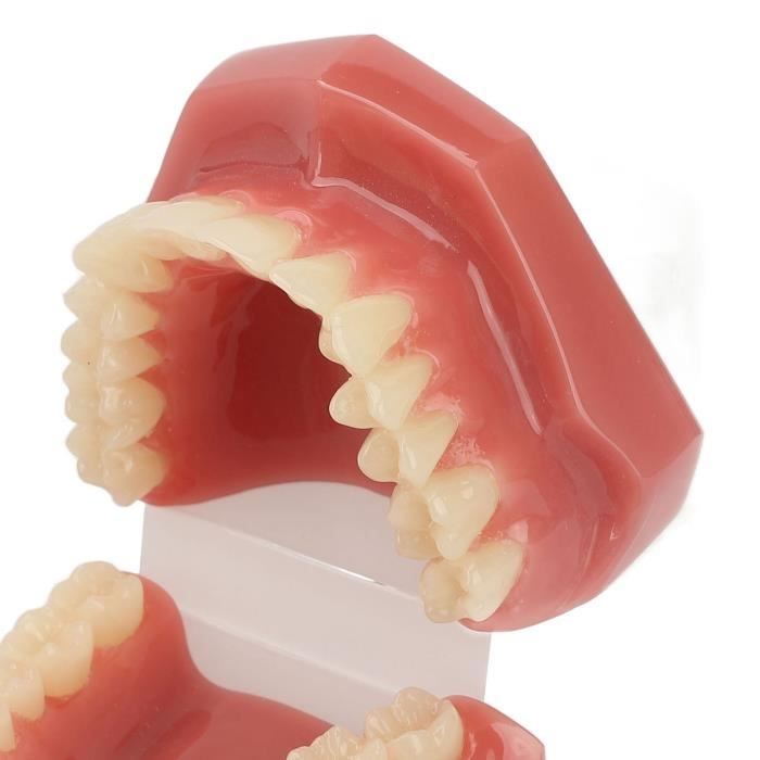 SURENHAP Modèle de prothèse adulte Modèle de dent 28 dents, modèle ...