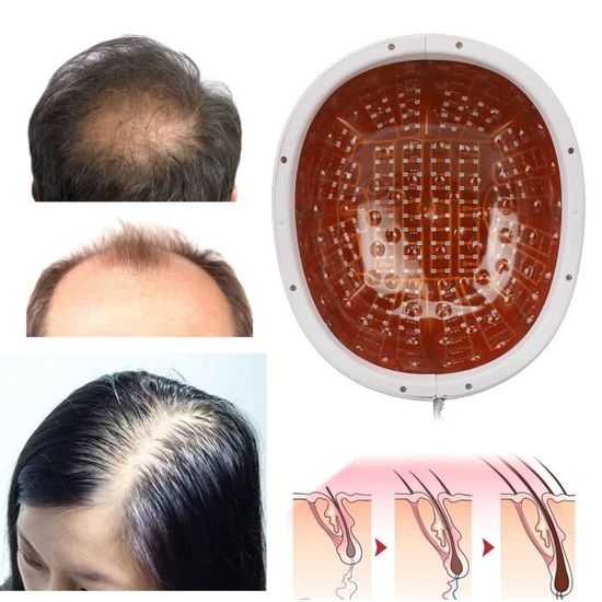 Casque de repousse des cheveux - SURENHAP - 3 vitesses - Énergie ...