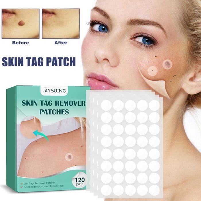 -Patchs Anti-acné Invisibles, 120 Pièces, Patch, Boutons, Dissolvant D ...