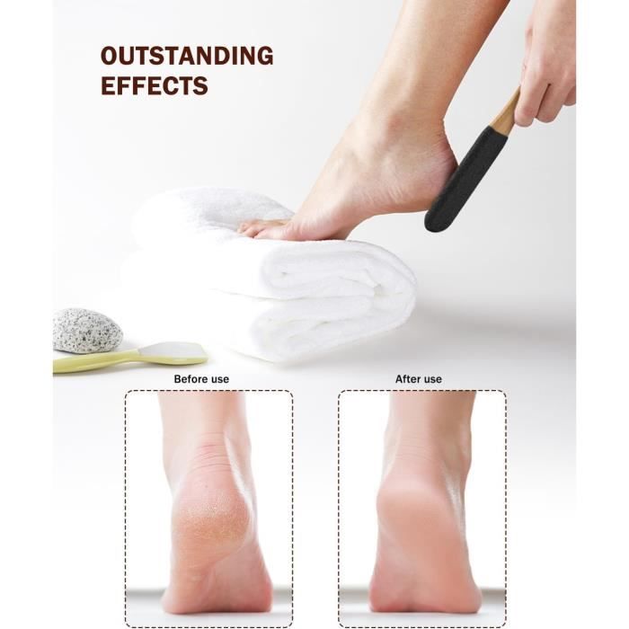 Lime De Pédicure Pour Pieds En Pierre Ponce - TRAHOO - Râpe Pour Pieds ...