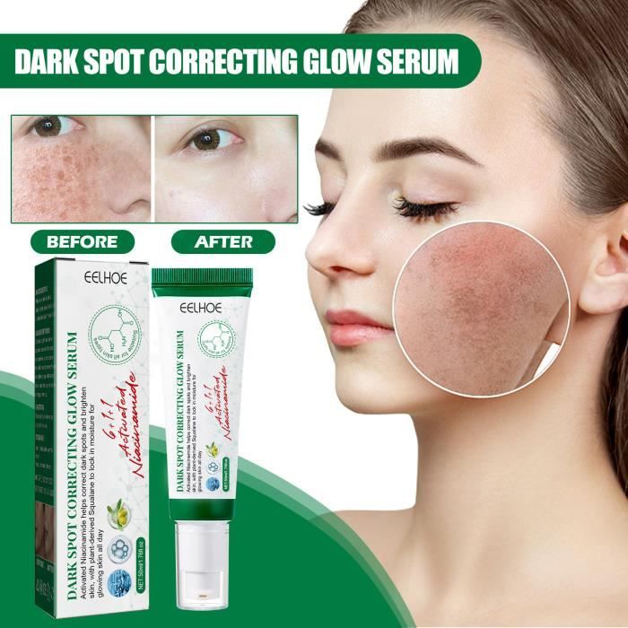 Serum Anti Tache Visage, Dark Spot Correcting Glow Serum, Creme Anti ...