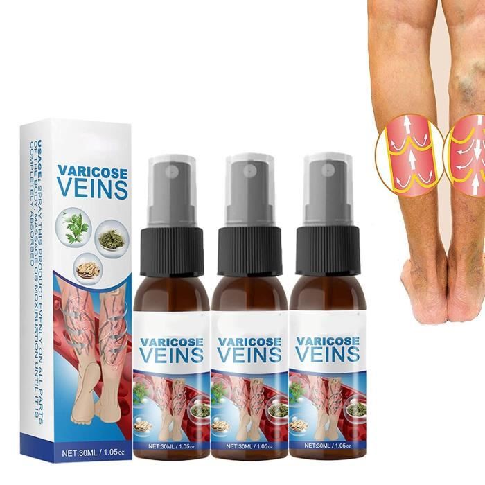 Lot de 3 sprays de traitement des varices, pour la guérison des varices ...