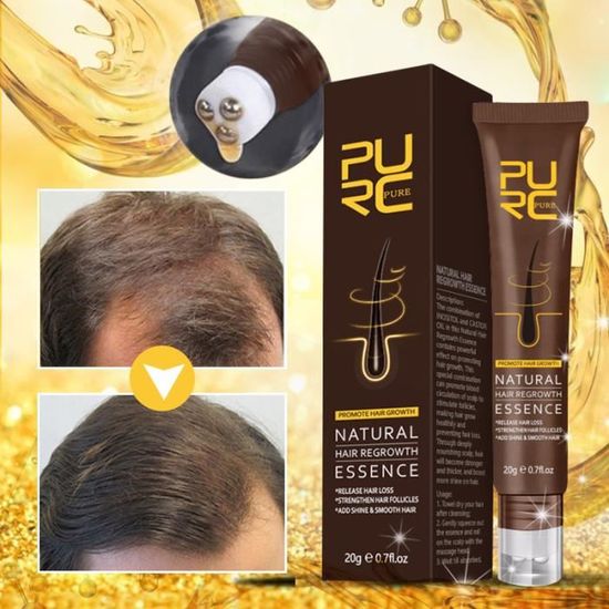 PURC Hair Growth Serum, Hair Care Product, Hair Serum, Hair Loss ...