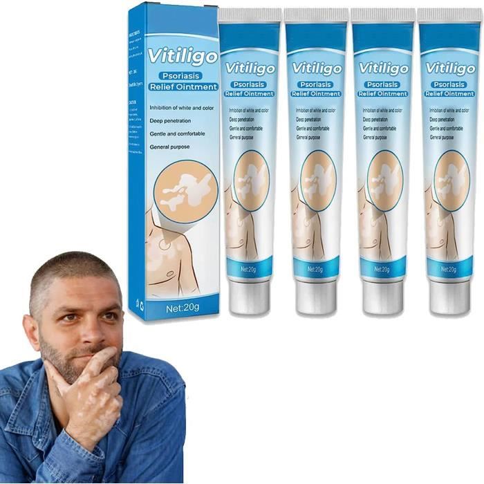 Vitiligo Soothing Ointment - Psoriasis Soothing Ointment, Helps to ...