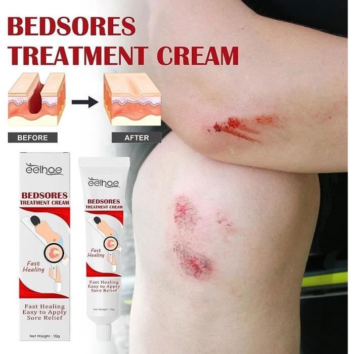 Crème Anti-escarres pour Personnes âgées - Rapide pour la Cicatrisation ...