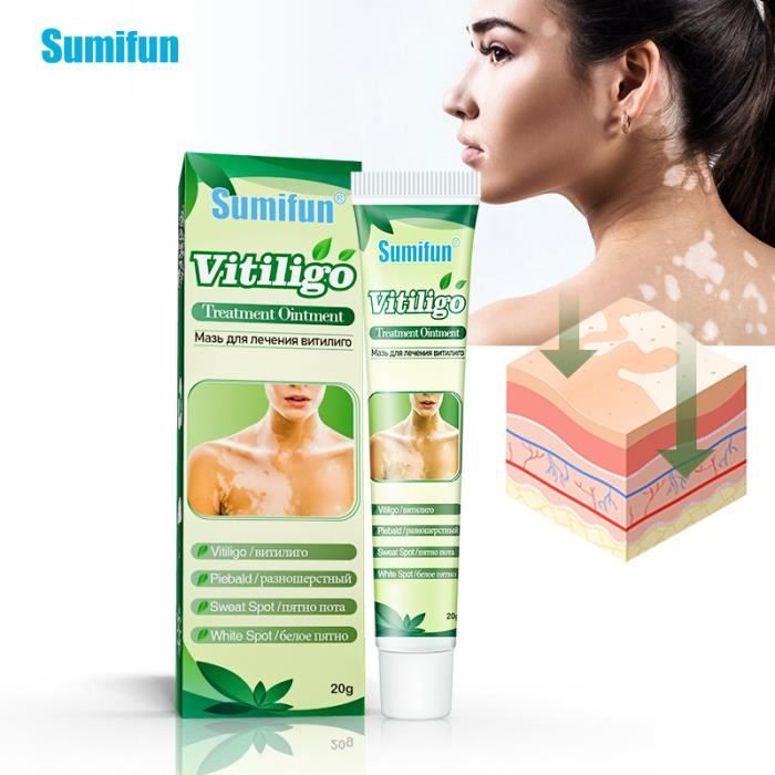 Sumifun Vitiligo Traitement Crème Antibactérien Psoriasis Pommade ...