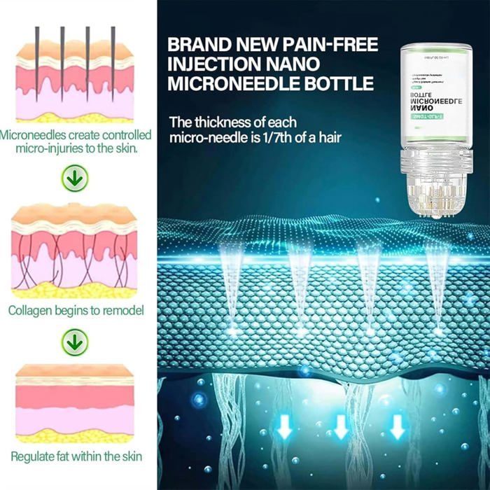 SMGT-GLP-1 Nano Microneedle Bottle, Nano Microneedle Bottle Weight Loss ...