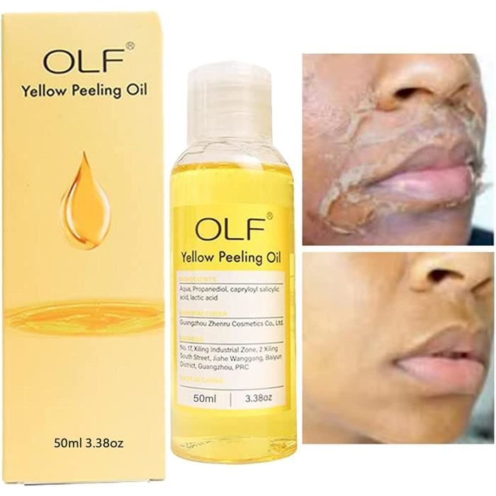 Peeling Oil Yellow, Natural Spot Whitening Yellow Peeling Oil, Super ...