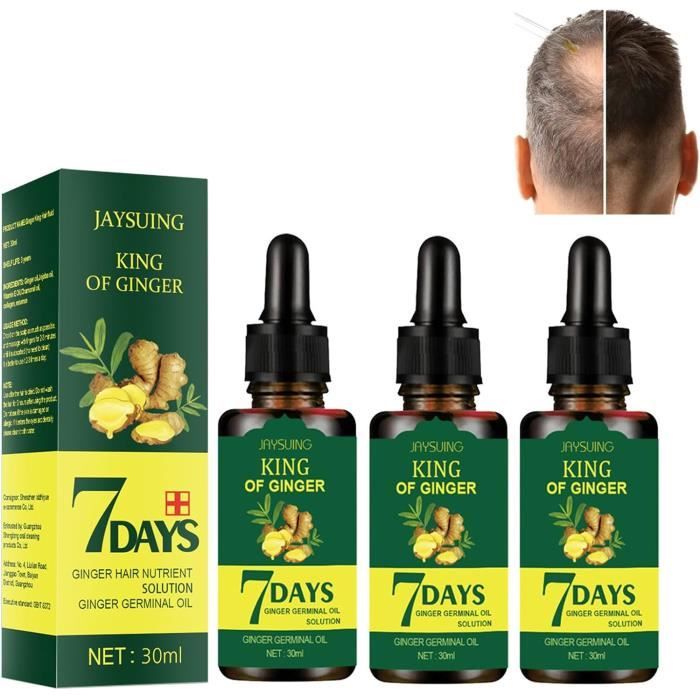 7 Days Hair Growth Serum de croissance des cheveux serum cheveux au gingembre huile de germe au gingembre traitement anti perte Cdiscount Au quotidien