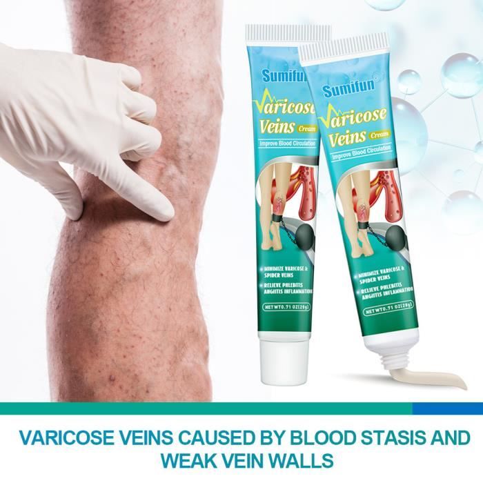 Sumifun nouvelle crème varices pour le traitement des vascularites ...