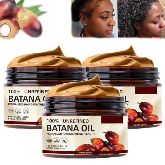 3pcs Botanix Batana Oil For Hair Growth, Batana Oil For Hair Growth ...