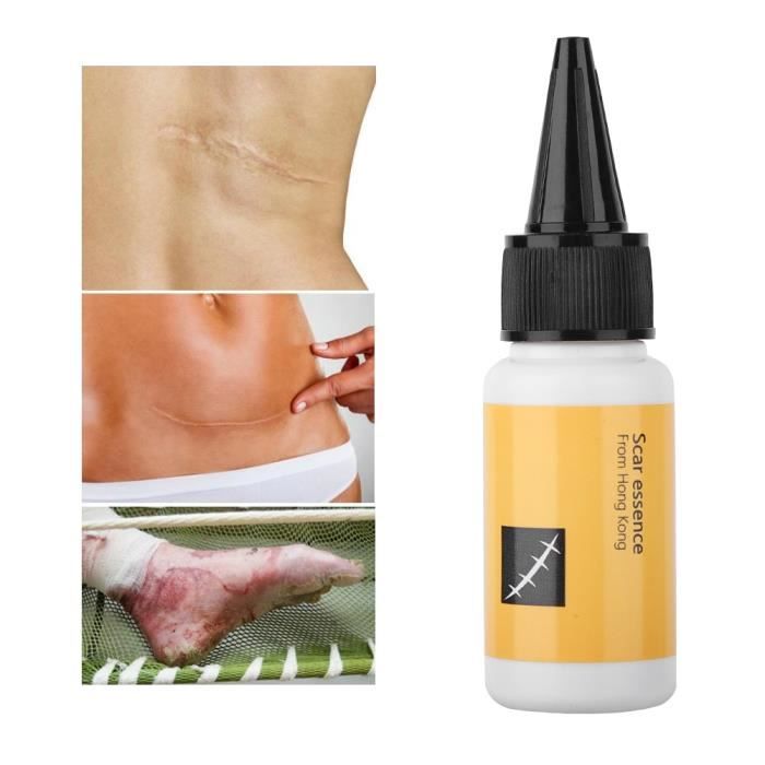 Cuque Élimination des cicatrices LIDORIA 20ML Essence cicatrice élimination des vergetures crème ...