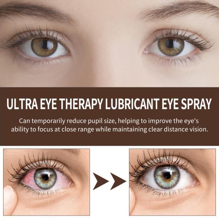 EELHOE Spray de lubrification pour les yeux Soulager la fatigue ...
