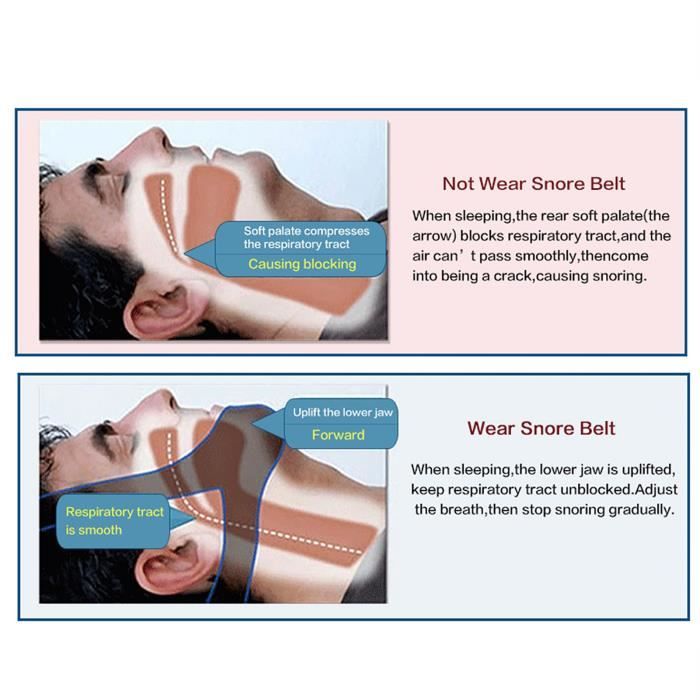 CHE Dispositif Anti Ronflement, Mentonnière Stop Ronflement, Meilleure ...