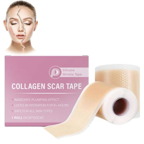 Silicone Scar Sheets, 1 Roll Collagen Silicone Scar Tape For Face ...
