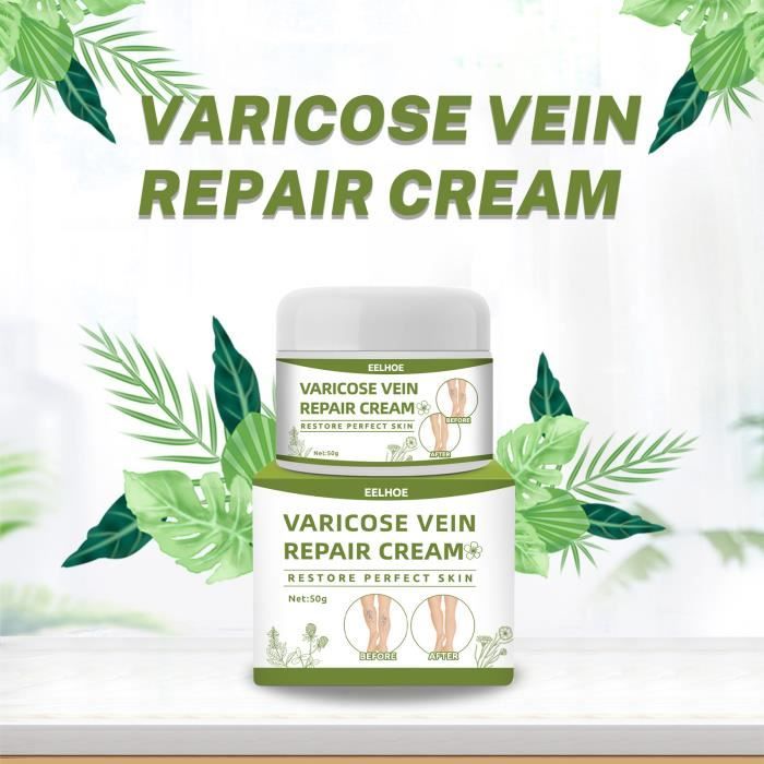 Crème Réparatrice De Varices, Tongmai Soulage Les Varices De La Jambe ...