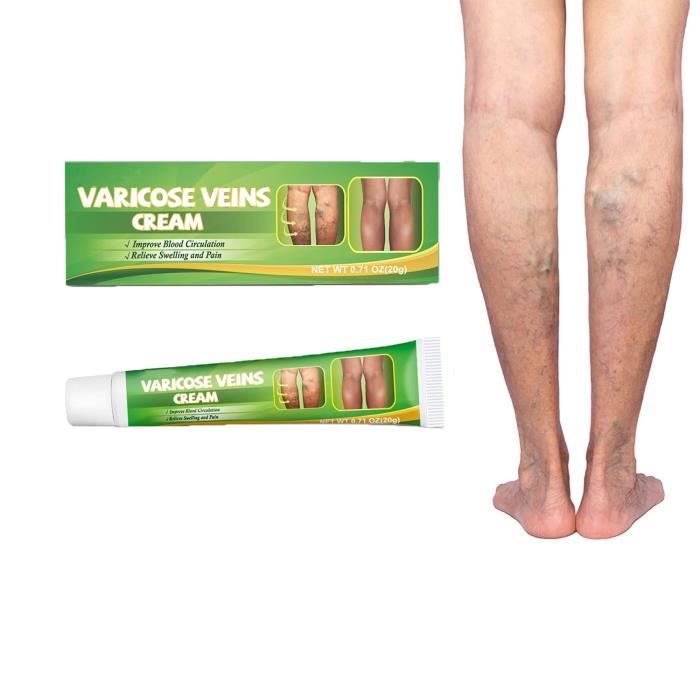 Crème apaisante pour les jambes anti-varices, crème de traitement des ...