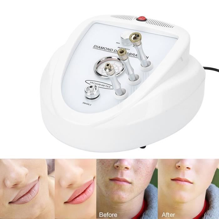 VIE 3 IN 1 Diamond Dermabrasion Machine Microdermabrasion Exfoliator ...