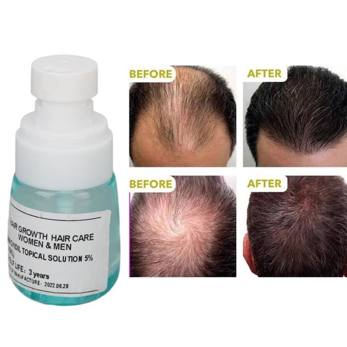 40ml Spray de Croissance des Cheveux Spray Volumateur Nourrissant ...