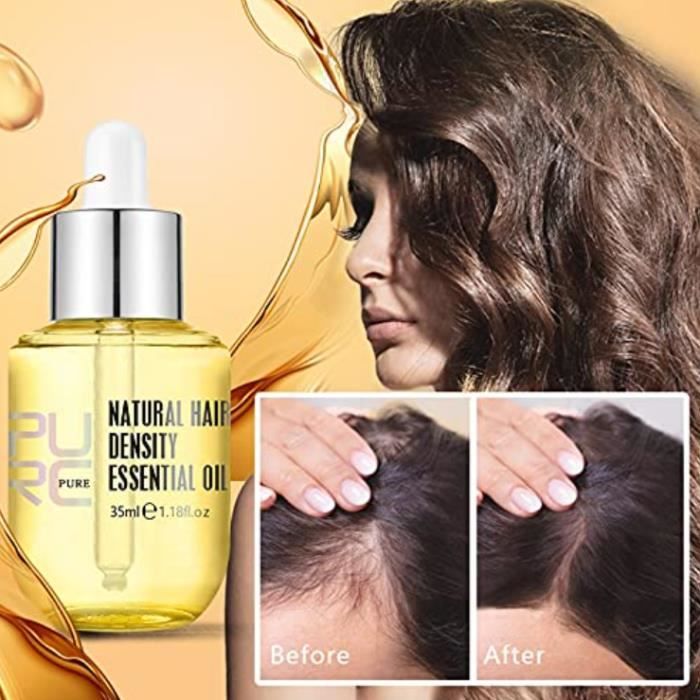 PURC Hair Growth Oil Ginger Essence Fast Growing Hair Products Scalp Treatment Hair Care Set 2PCS Set