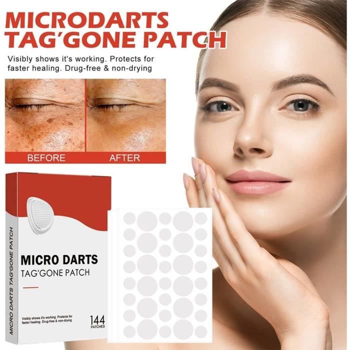 432 PCS Patch Bouton Pimple,Patch Bouton Acne Hydrocolloid, Invisible ...