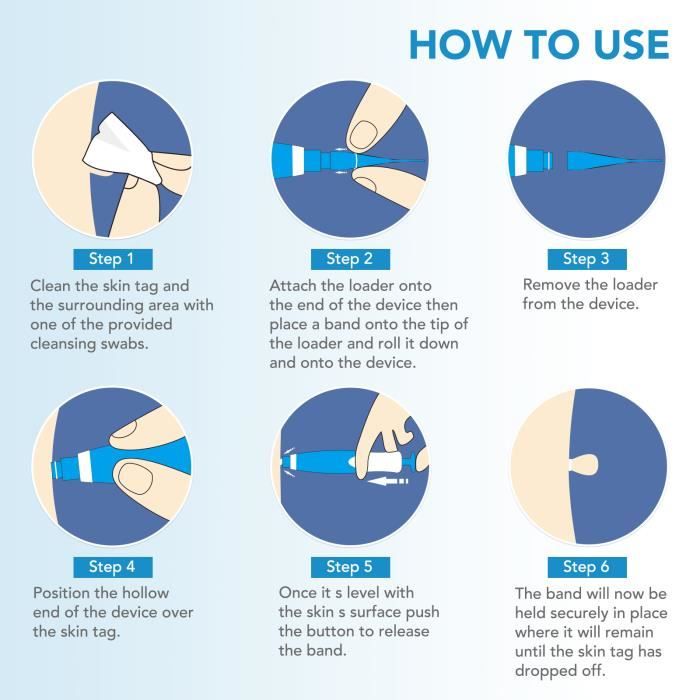 Outil de Suppression des acrochordons -Correcteur d'acrochordons 2 en 1 ...