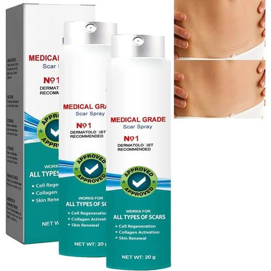 Scar Remove Advanced Scar Spray,Scar Remove Medical Grade Scar Spray ...