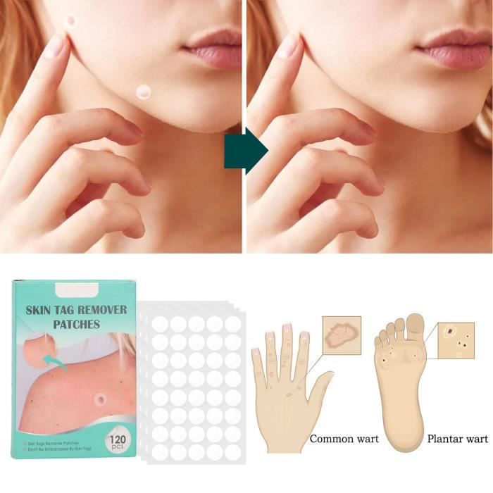 GOO patch anti-verrues 120 pièces tampons anti-verrues plantaires ...