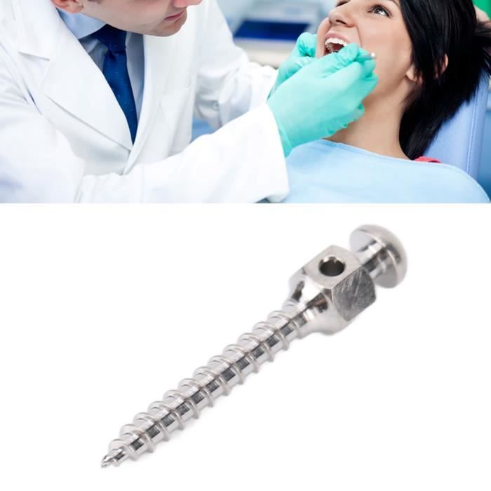 Vis orthodontique pour micro-implants Vis d'ancrage dentaire à filetage ...