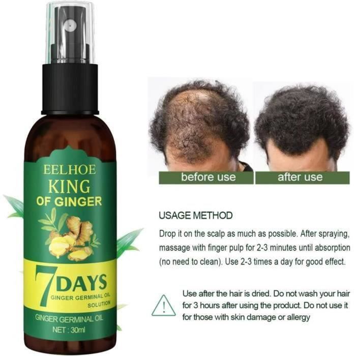 King of Ginger 7 Days Hair Growth Ginger Germinal Oil Ginger Oil for Hair Growth Natural Ginger Hair Growth Serum Hair Care Regrowth Cdiscount Au quotidien
