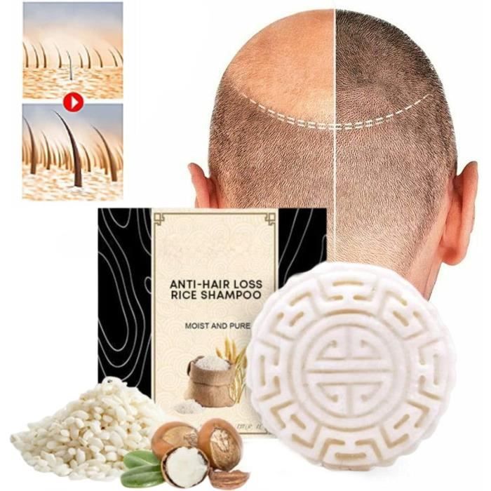Anti-Hair Loss Rice Shampoo Bar - Rice Water Shampoo for Hair Growth ...