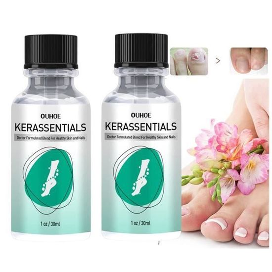 Kerassentials Toenail Fungus Treatment Oil, kerassentials for toenail ...