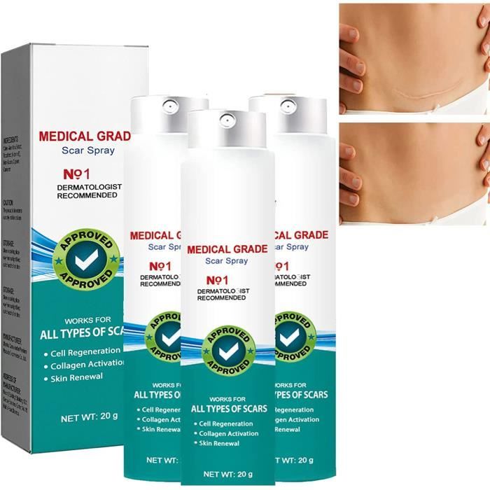 Scar Remove Advanced Scar Spray,Scar Remove Medical Grade Scar Spray ...