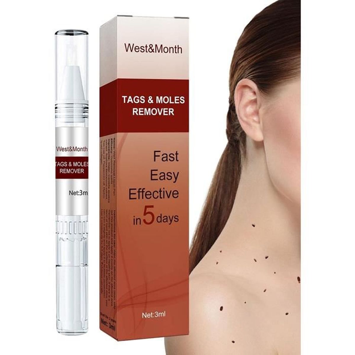 Stylo Pour Enlever Grain De Beauté Anti Grain De Beauté Skin Tag ...