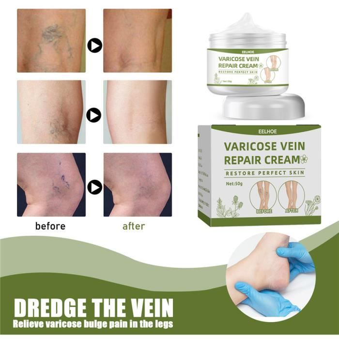 Gel pour les jambes Crème réparatrice des varices à base d'extraits de ...